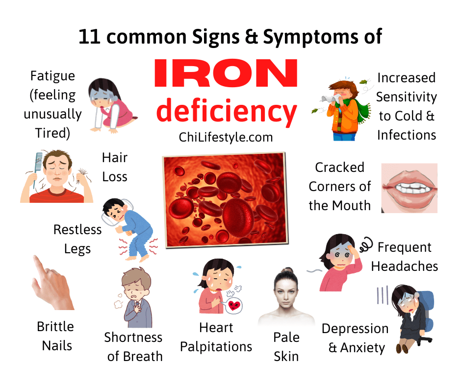 11 Common Symptoms of Iron Deficiency - ChiLifestyle